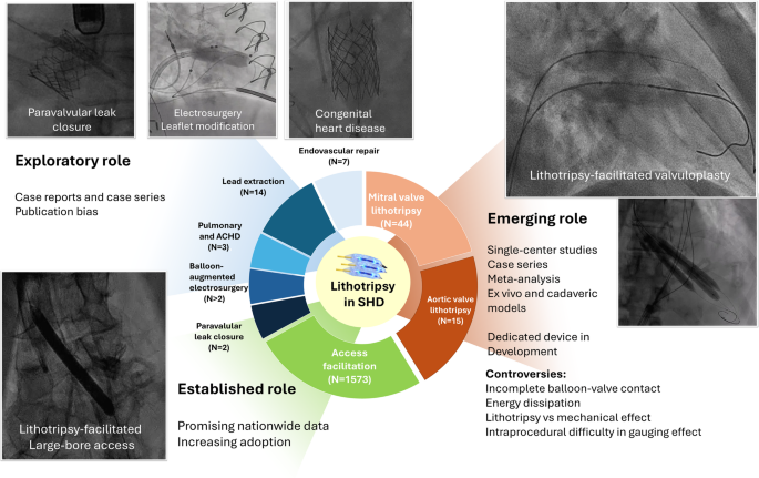 The Emerging Role of Lithotripsy in Structural Heart Interventions ...