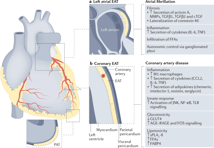 The Role of Pericardial Fat in Cardiometabolic Disease: Emerging ...