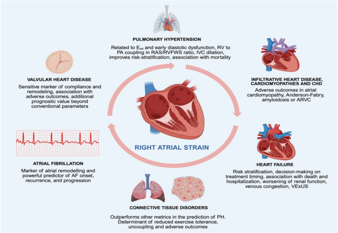 Echocardiographic Deformation Imaging of the Right Atrium: A New ...