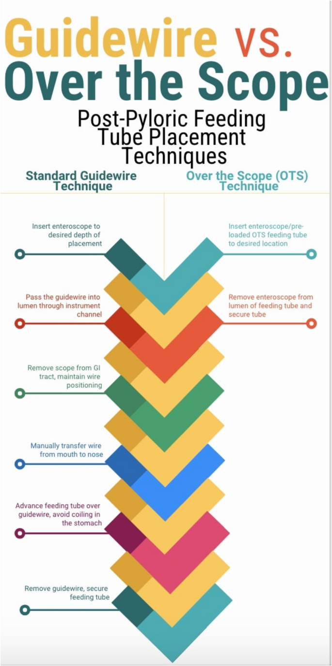 Success Rates for Endoscopic Placement of Post-Pyloric Nasoenteric Tube ...
