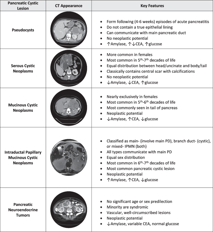 Pancreatic Cystic Lesions in the Older Patient: A Review of Clinical ...
