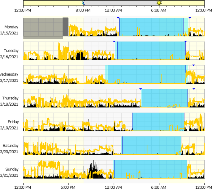 Methods for Assessment of Sleep and Circadian Rhythms in Cardiovascular ...