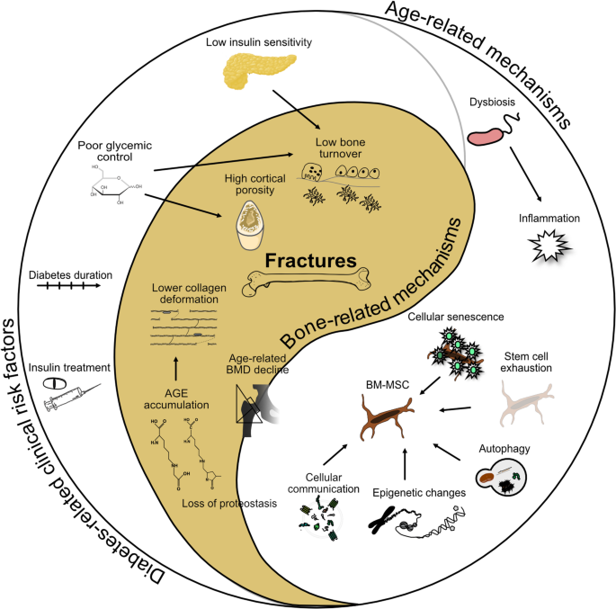 New Aspects of the Pathophysiology of Diabetic Bone Fragility – Type 2 ...