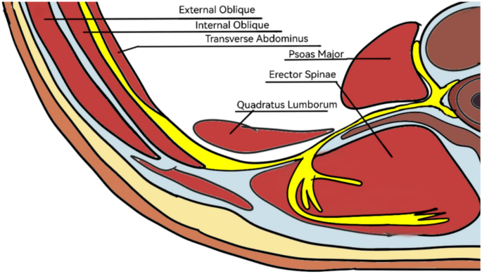 Pharmacologic Analgesia for Cesarean Section: An Update in 2024 ...