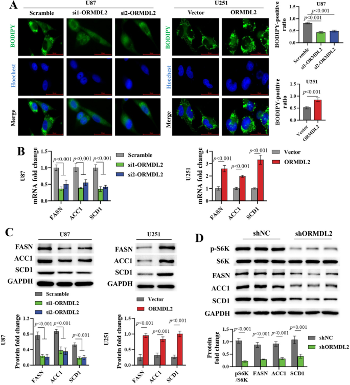 ORMDL2 Promotes the Growth of Glioma through mTORC1-Mediated Fatty Acid ...