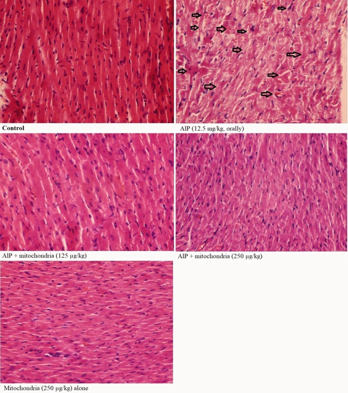 Mitotherapy with Fresh Isolated Cardiac Mitochondria Via Injection Into ...