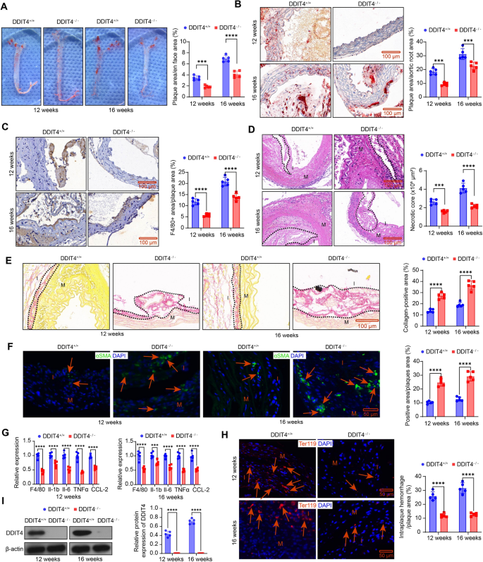ETV5-Mediated Transcriptional Repression of DDIT4 Blocks Macrophage Pro ...
