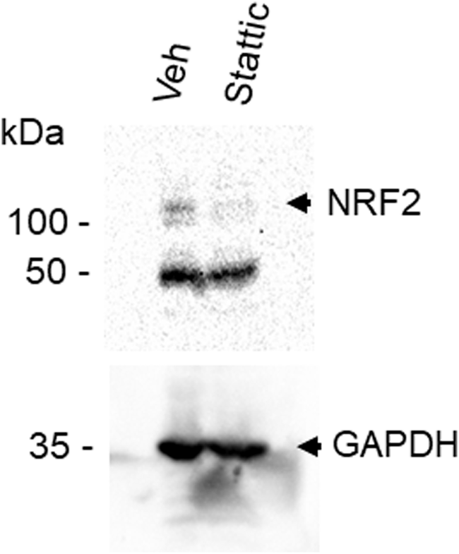STAT3 Regulates the Redox Profile in MDA-MB-231 Breast Cancer Cells ...