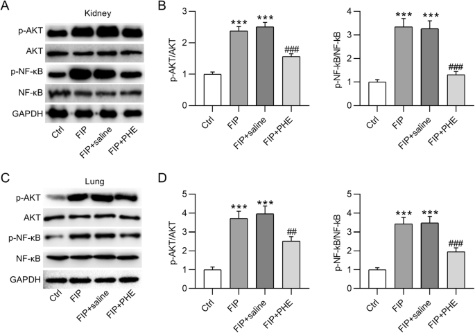 Phellodendrine Exerts Protective Effects on Intra-abdominal Sepsis by ...