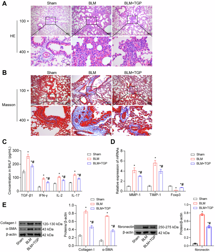 The Paeonol of Total Glucosides of White Peony Regulates the ...