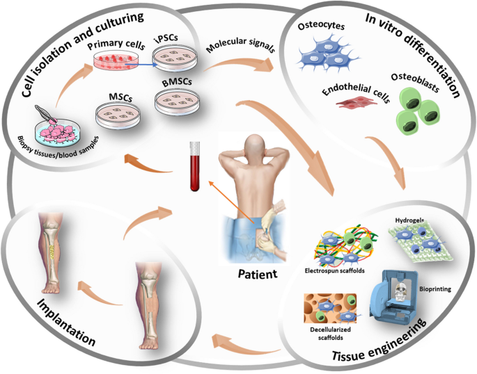 Stem Cells in Bone Tissue Engineering: Progress, Promises and ...