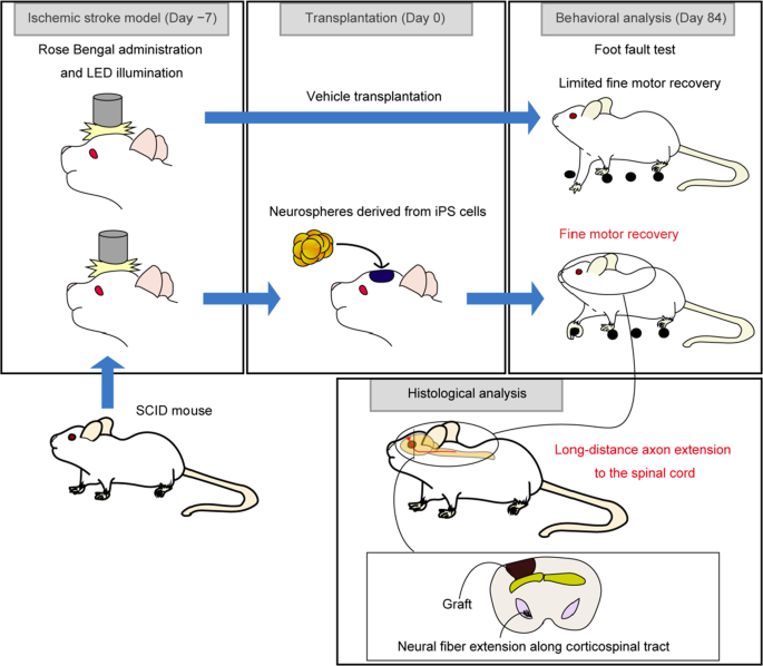 Transplantation of Human iPS Cell-derived Cerebral Cortical Neurons ...