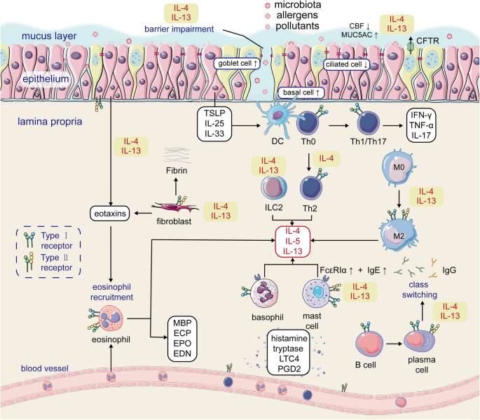 Targeting IL-4/IL-13 Signaling Pathways in Chronic Rhinosinusitis with ...