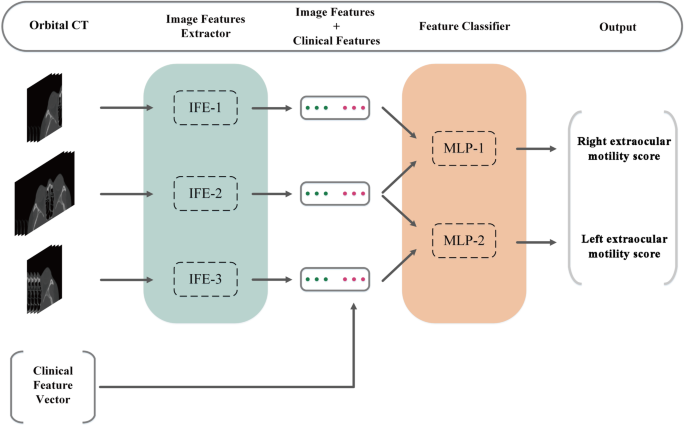 CT-based artificial intelligence prediction model for ocular motility ...