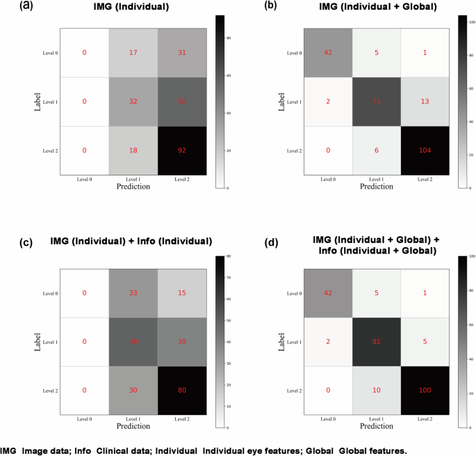 CT-based artificial intelligence prediction model for ocular motility ...
