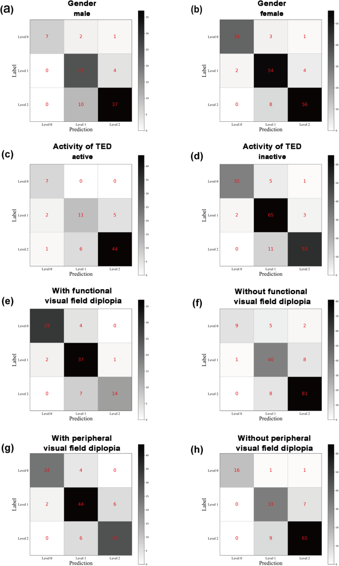 CT-based artificial intelligence prediction model for ocular motility ...