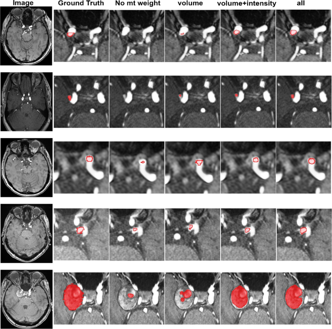 Morphology and Texture-Guided Deep Neural Network for Intracranial ...