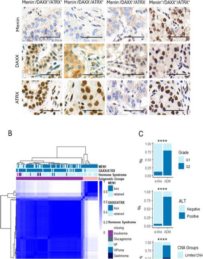 Correction to: Molecular Subtypes of Pancreatic Neuroendocrine Tumors ...