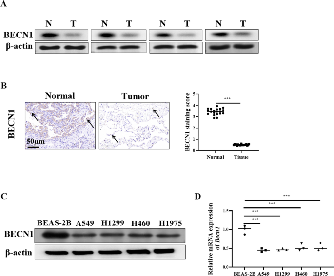 BECN1 activator peptide Tat-beclin 1 promotes ferroptosis via the BECN1 ...