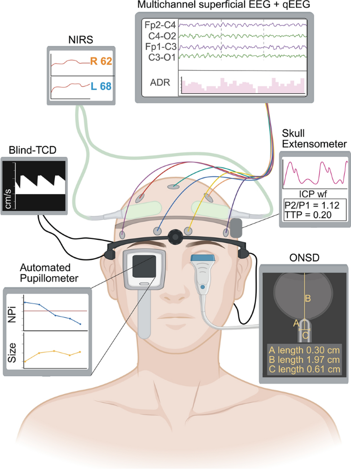 Practicalities of noninvasive neuromonitoring in intensive care ...