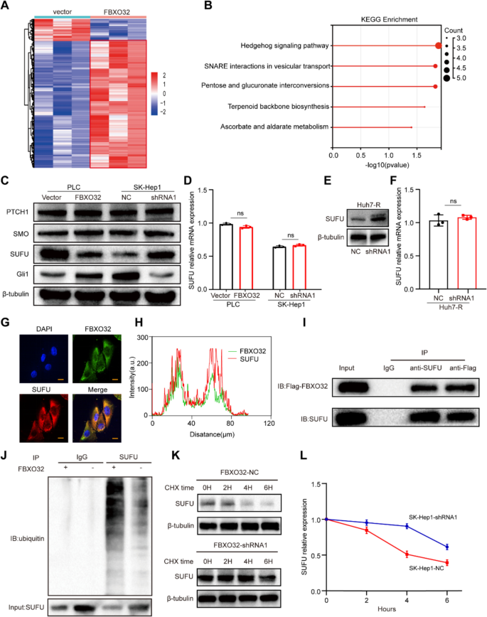 FBXO32 ubiquitination of SUFU promotes progression and lenvatinib ...