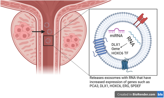 From bench to bedside: the evolution and future of prostate-specific ...