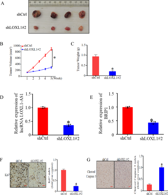 LncRNA LOXL1-AS1 promotes ovarian cancer progression by enhanced BRIP1 ...