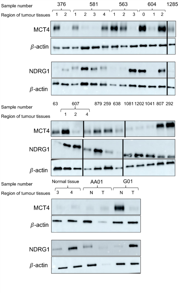Selective regulation and cellular metabolism by the lactate transporter ...