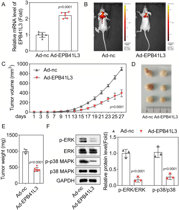 EPB41L3 Inhibits the Progression of Cervical Cancer Via the ERK/p38 ...