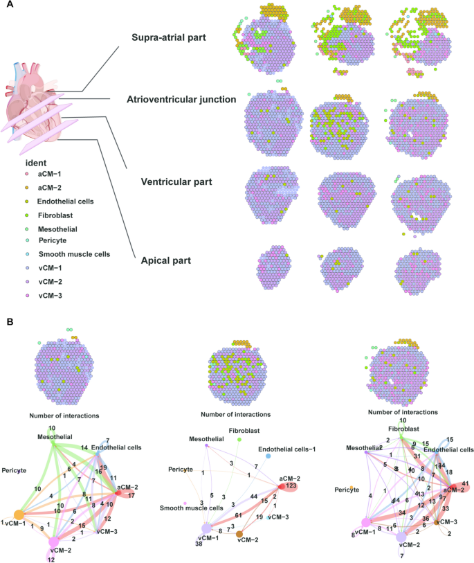 Integrative Single-Cell and Spatial Transcriptomics Reveal Functional ...