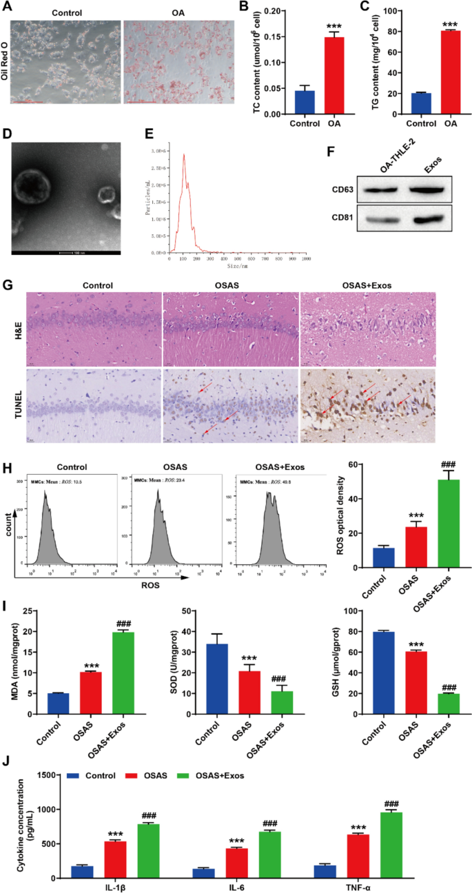 Exosomal LncRNA MALAT1 Derived from Hepatocytes in Nonalcoholic Fatty ...