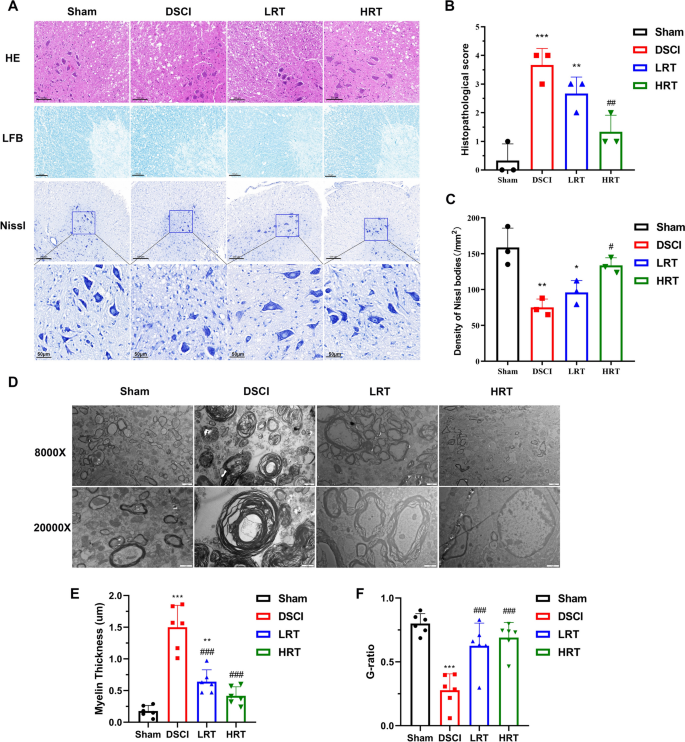 Rutin Attenuates Distraction Spinal Cord Injury by Inhibiting ...