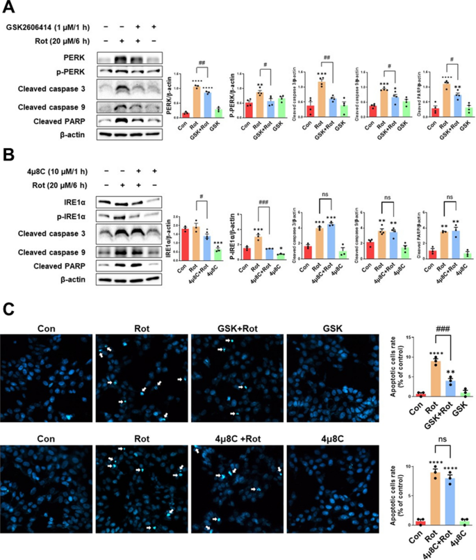 CK2α Regulates Endoplasmic Reticulum Stress-Mediated Mitophagy via the ...