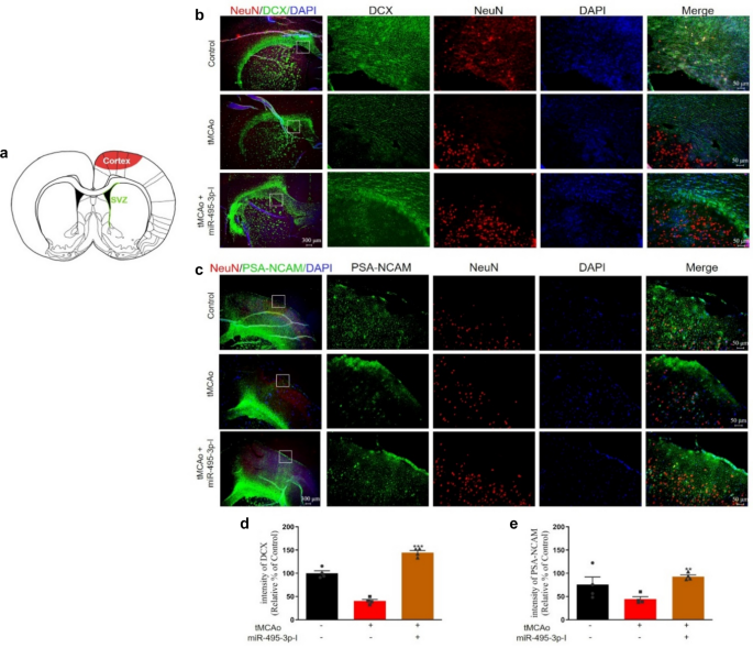 miR-495-3p Attenuates Neuronal Apoptosis Through The Activation of Wnt ...