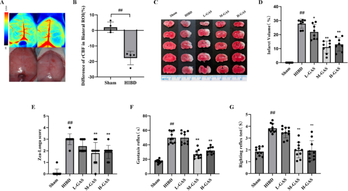 Gastrodin Injection Relieves Hypoxic-Ischemic Brain Injury in Newborn ...