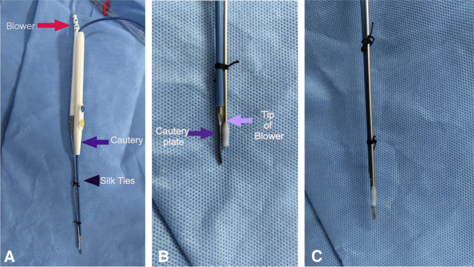 Comparison of conventional and modified carbo-dissection techniques for ...