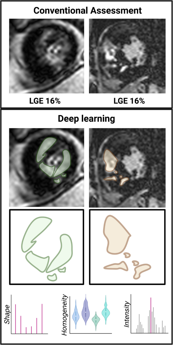 Role of cardiac magnetic resonance imaging in the management of ...