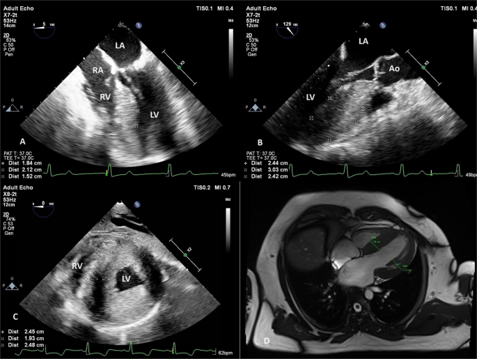 Anaesthesia and perioperative transoesophageal echocardiography in ...