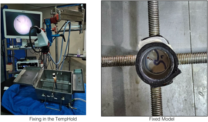 Elevating Expertise: A Comprehensive Guide to Two Handed Endoscopic ...