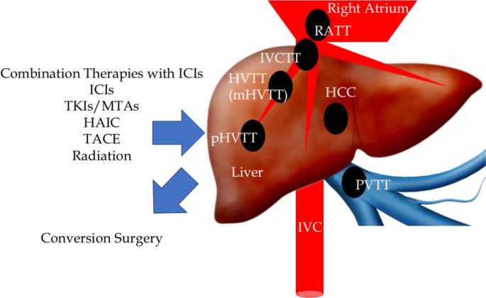 Combination therapies with immune checkpoint inhibitor-based combination therapies for ...