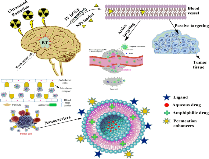 Nanotechnology Driven Lipid and Metalloid Based Formulations Targeting ...