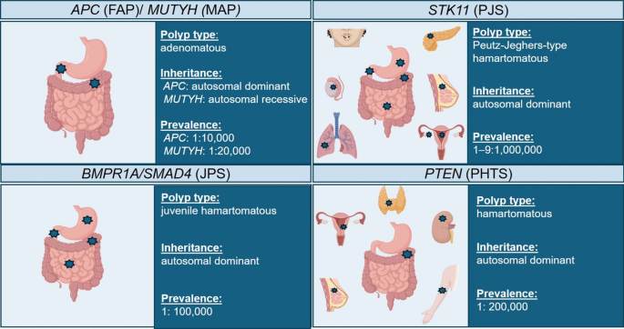 Genetic predisposition to polyposis syndromes | Clinical and ...