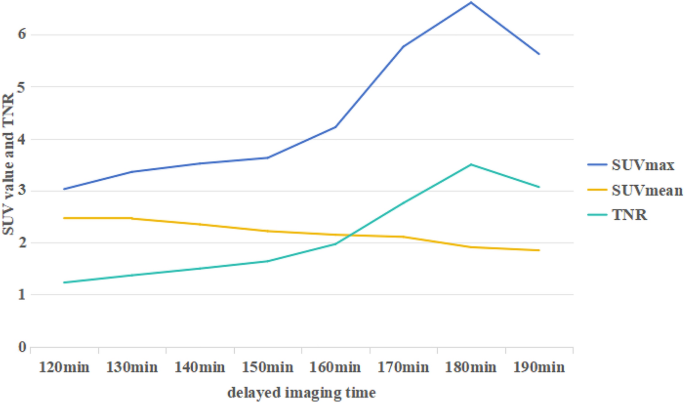 Analysis of the best time-point for 18F-FDG PET/CT delayed imaging in ...