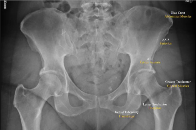 Hip Sideline Emergencies and Hip Injuries in Elite Athletes | Current ...