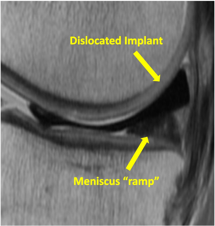 Report on Evolving Indications, Technique, and Outcomes of Novel And ...
