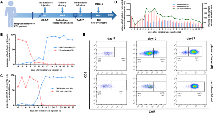 Sequential intrathoracic injection and intravenous infusion of BCMA CAR ...