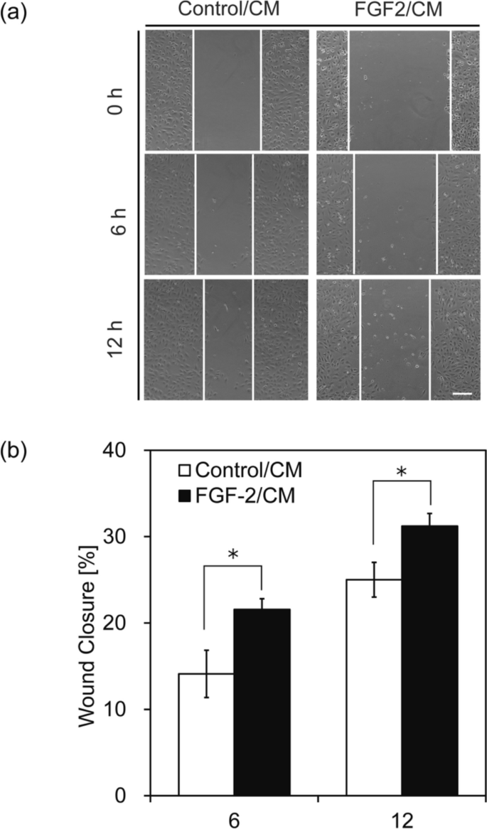 FGF-2–Overexpressing Adipose-Derived Stem Cells as a Paracrine Platform ...