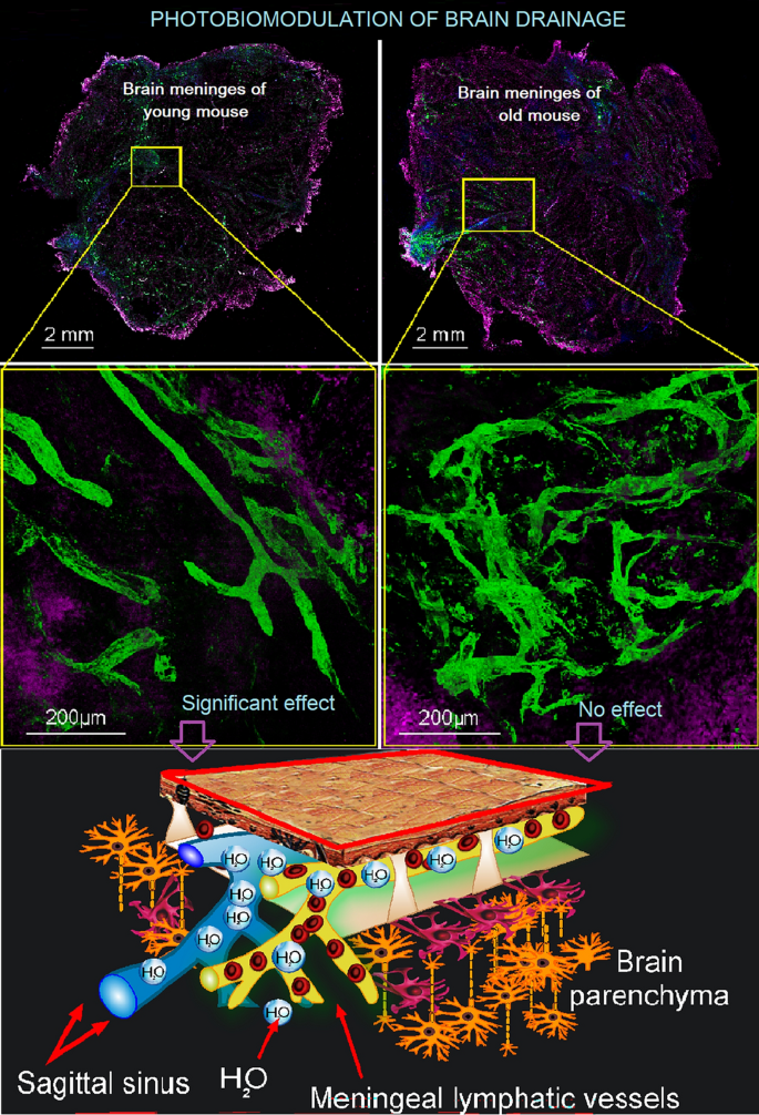 Age as a limiting factor for effectiveness of photostimulation of brain ...