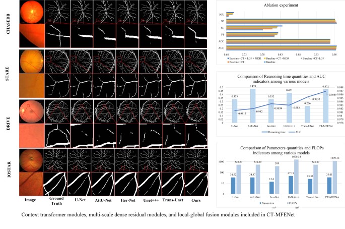CT-MFENet: Context Transformer and Multi-Scale Feature Extraction ...