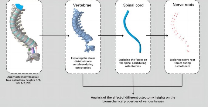 Excessive Vertebral Shortening in Spinal Osteotomy Increases the Risk ...